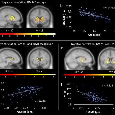 Manual Segmentation Of An Individual Snvta Within The Midbrain The