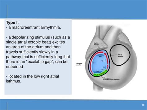 Atrial Flutter Afl Management Principals