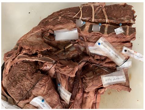 Diagram Of Prac Ga Obturator Nerve Image Quizlet