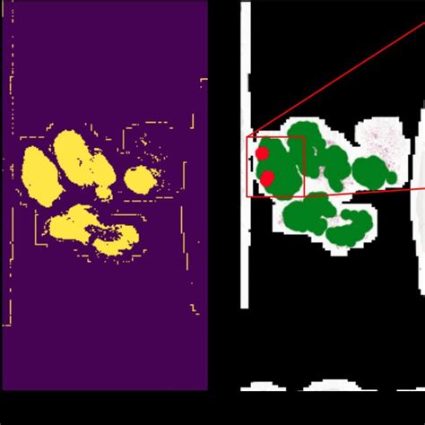 Patch Extraction Process A Whole Slide Image B Segmented Tissue