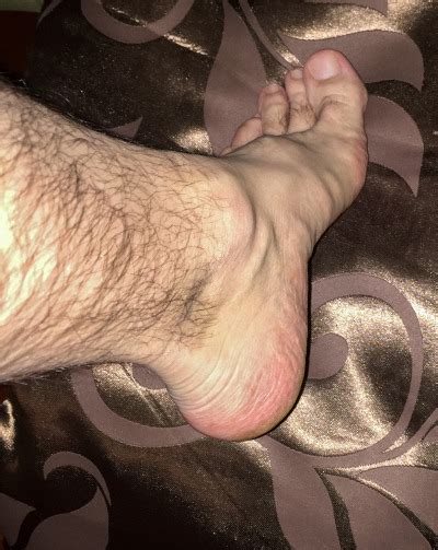 My Foot🦶🏼 Tumbex