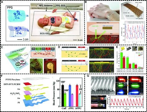 Flexible Ppg Is Used For Pulse Wave Monitoring A Images Top Left