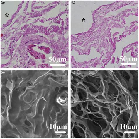 A He Image Of Sis Without Decellularization Showing Many Blue Download Scientific Diagram