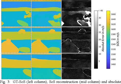 Figure 1 From Deep Learning Based Speed Of Sound Reconstruction For Single Sided Pulse Echo