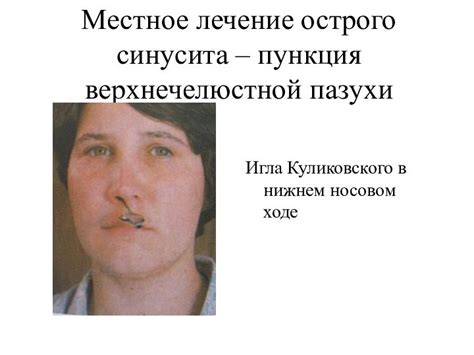 Патология носа и околоносовых пазух у детей