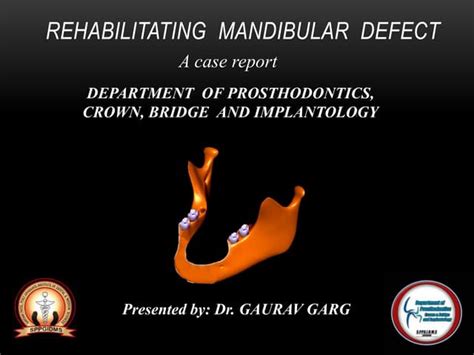 Mandibular Recnstruction Ppt