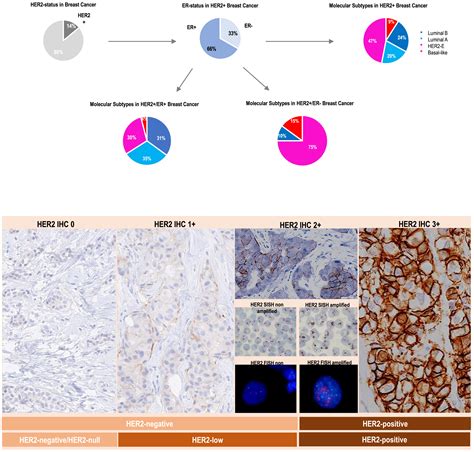 Emerging Treatments In Her2 Positive Advanced Breast Cancer Keep