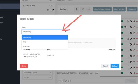 Upload Report Advapacs Docs