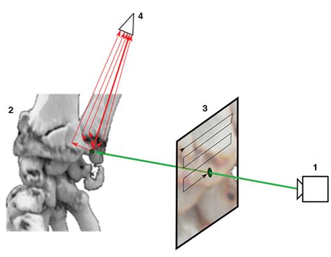 Forensic 3d Visualization Of Ct Data Using Cinematic Volume Rendering