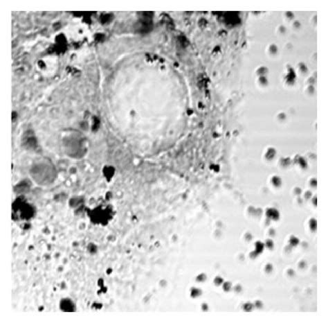 Localization Of Crystalline Anatase And Rutile Tio2 Nps In Hepg2 Cells