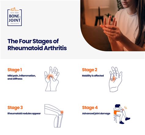 The Four Stages Of Rheumatoid Arthritis New York Bone And Joint Specialists