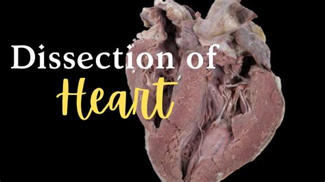 How To Dissect Heart By Dr Monica Youtube