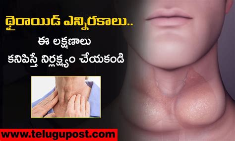 Thyroid థైరాయిడ్‌ ఎన్నిరకాలుఈ లక్షణాలు కనిపిస్తే నిర్లక్ష్యం చేయకండి