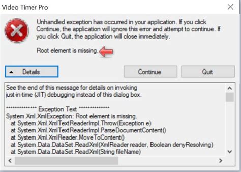 support timer pro professional