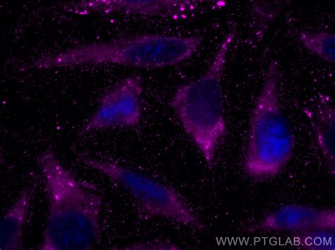 Galectin 3 Antibody Cl647 60207 Proteintech