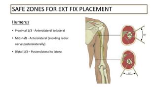 Principle Of External Fixation For Open Fracturepdf