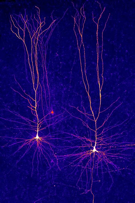 Human Brain Mapping 2017 Abstracts Lockqskills