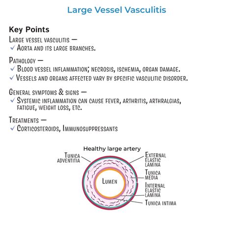 Clinical Pathology Glossary Vasculitis Large Vessels Ditki Medical And Biological Sciences