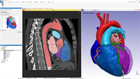 3d image processing news and events simpleware synopsys