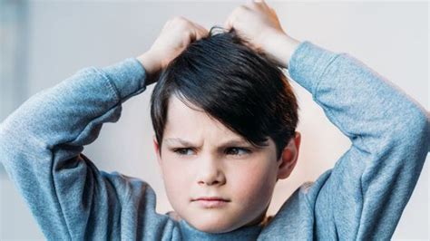 Tophealthanswers Cradle Cap What It Is Symptoms And Treatment