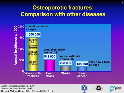 Osteoporotic Fragility Fractures Treatment