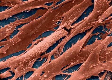 Fibroblasts Sem Stock Image C0305194 Science Photo Library