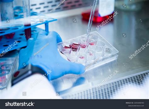 Experiment On Cell Culture At Danita Foster Blog