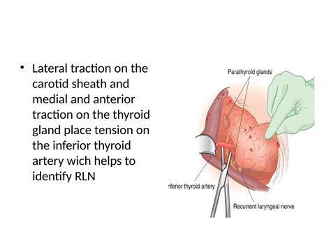 Thyroidectomy Pptxtechniques Of Thyroidectomyppt