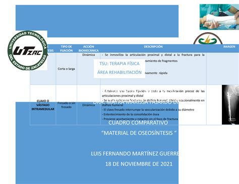 Tipo De Osteosíntesis Tipos De Osteosintesis Universidad TecnÓlogica Del Estado De Zacatecas