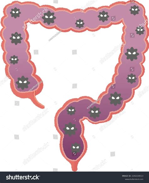 Colitis Disease Unknown Cause Which Chronic Stock Vector Royalty Free