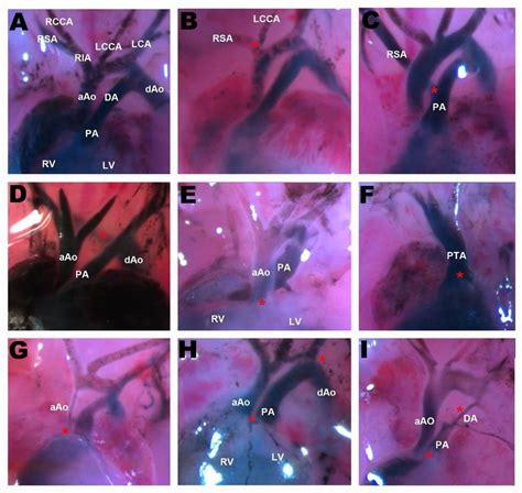 4 Outflow Tract [oft] Download Scientific Diagram