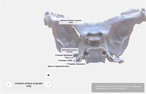 Sphenoid Bone Anatomy Free 360° 3d Interactive Views