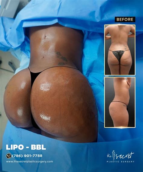 Before And After Plastic Surgery The Secret Plastic Surgery