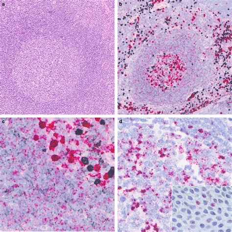 Ultrasensitive Automated Rna In Situ Hybridization For Kappa And Lambda