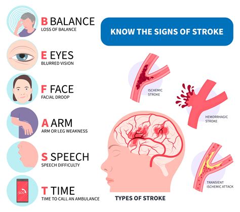 Stroke Face Symptoms