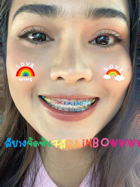 สียางจัดฟัน สายรุ้ง 💚💛🧡 ️🩷💜🩵💙 แกลเลอรีที่โพสต์โดย Paveesuda Raksa Lemon8