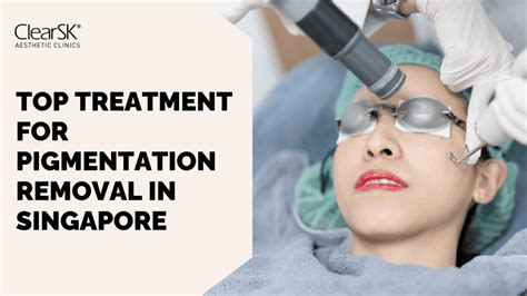 Top Treatment For Pigmentation Removal In Singapore Clearsk Aesthetic