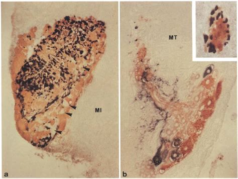 A B Double Staining By Sequential Use Of Immunogold Silver Staining Download Scientific
