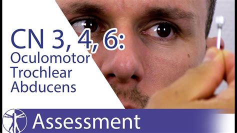 Trochlear Nerve Palsy Eye Position