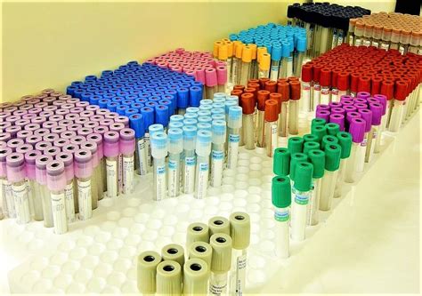 What Color Vacutainer For Bmp At Claudia Eric Blog