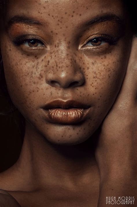 Pin By Side🥷🏿2 On B L A C K • Aesthetic Beautiful Freckles Freckles