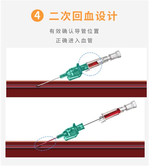 德国贝朗静脉留置针安全型introcan Safety W 英全康 18g 安全型 带翼 德国贝朗静脉留置针价格 型号 参数 上海掌动医疗科技有限公司
