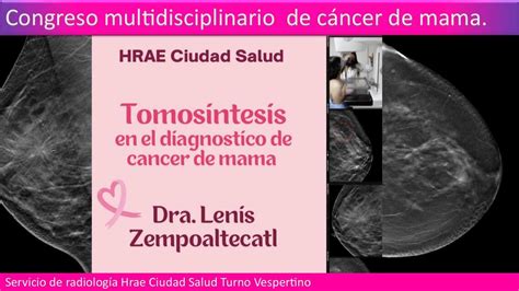 Tomosintesis En El Cancer De Mama Lenis Zempoaltecatl Udocz
