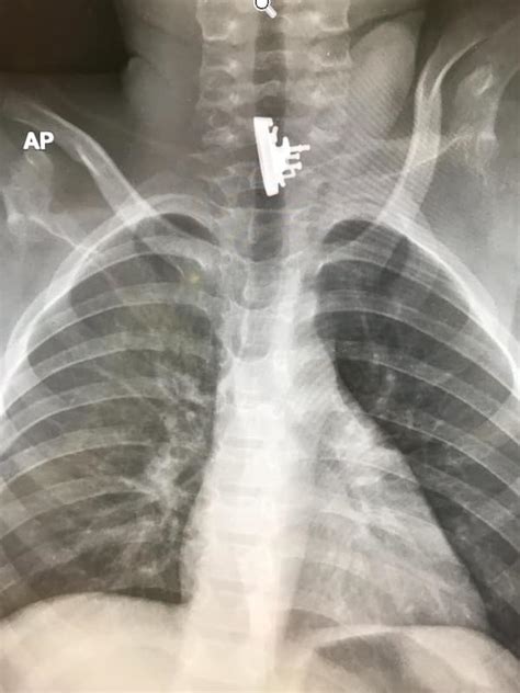 31 Weird X Ray Photos That Yes They Really Are Real