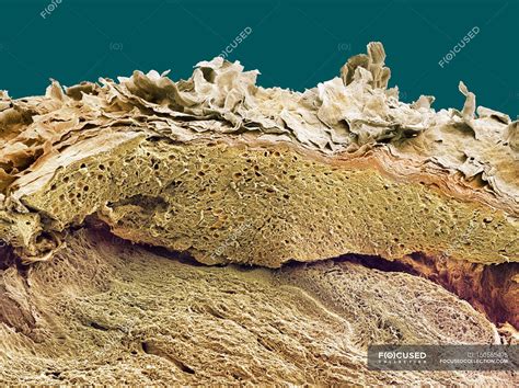 Coloured Scanning Electron Micrograph Sem Of A Section Through Healthy Skin — Capillaries