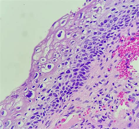 7 Cytopathic Effect Royalty Free Photos And Stock Images Shutterstock