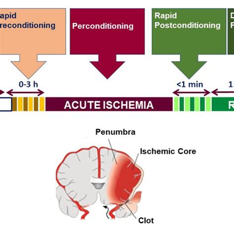 Temporal Profile Classification Of Brain Conditioning Download Scientific Diagram