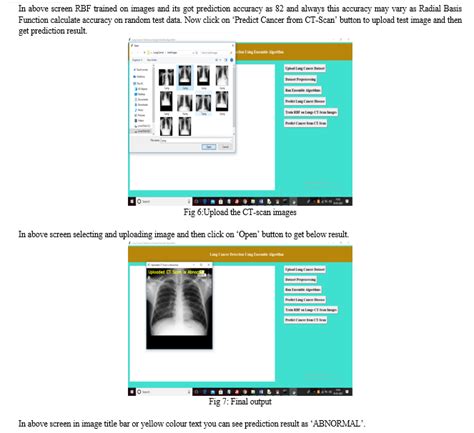 Lung Cancer Detection Using Ensemble Algorithm