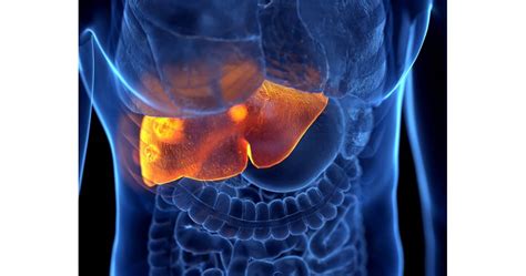 Омазнен черен дроб Какво представлява и как да го предотвратим