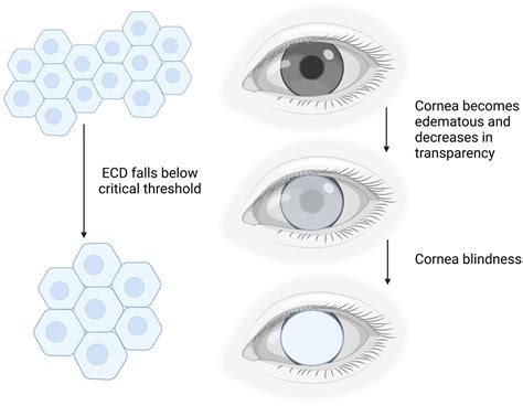 Congenital Hereditary Endothelial Dystrophy